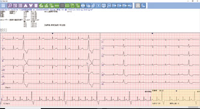 検査データ管理システム FMLC-50 | フクダ電子