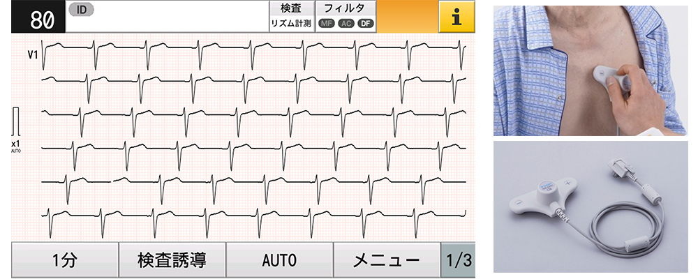 心電図解析収録器 ESP-500 | フクダ電子