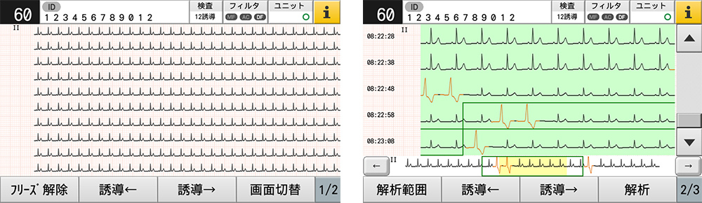 心電図解析収録器 ESP-500 | フクダ電子