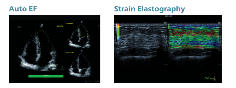 汎用超音波画像診断装置 Versana Premier R2 | フクダ電子